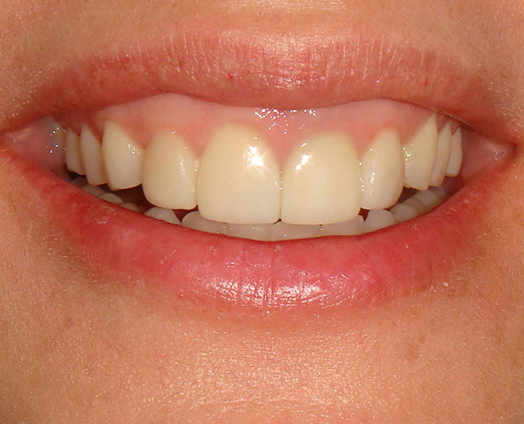 Amanda | Brian Klym, DDS